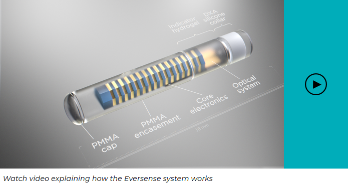Eversense Sensor | Eversense CGM