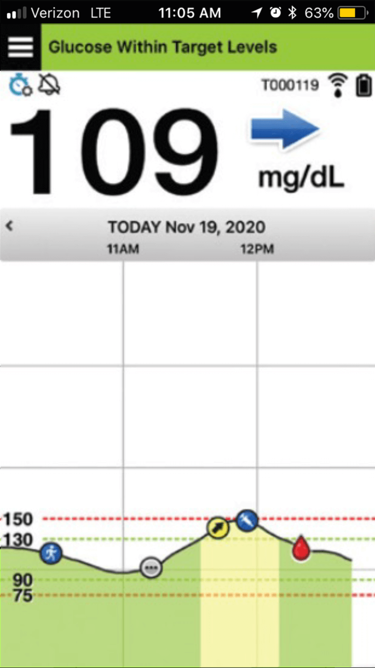 Getting Started Eversense v3